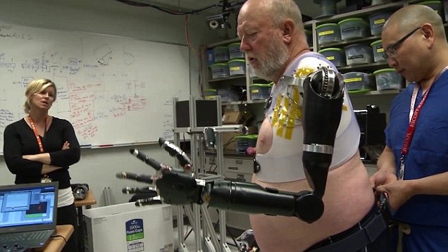 Amputee makes history with modular prosthetic limb - The Online Citizen